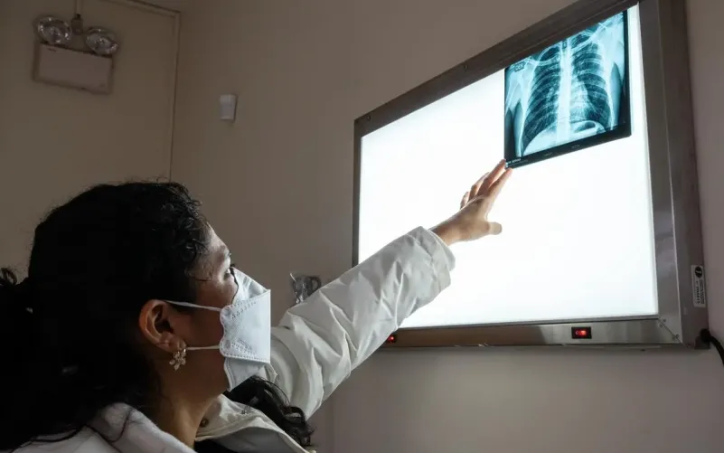 Landmark Clinical Trial Redefines Multidrug-Resistant Tuberculosis ...